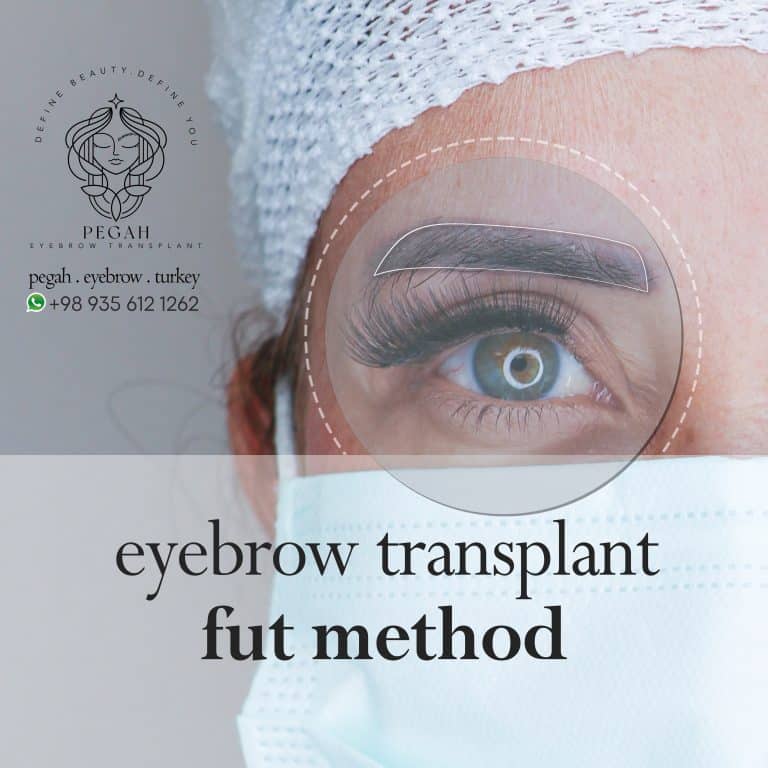 Eyebrow Transplant FUT Method | Pegah Eyebrow Transplant